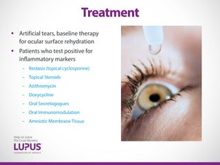 Lupus and the Eye | PDF