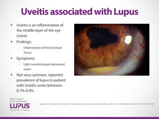 Lupus and the Eye | PDF