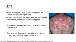 lupus cutaneo 2 segmento de clase de dermatologia.pptx