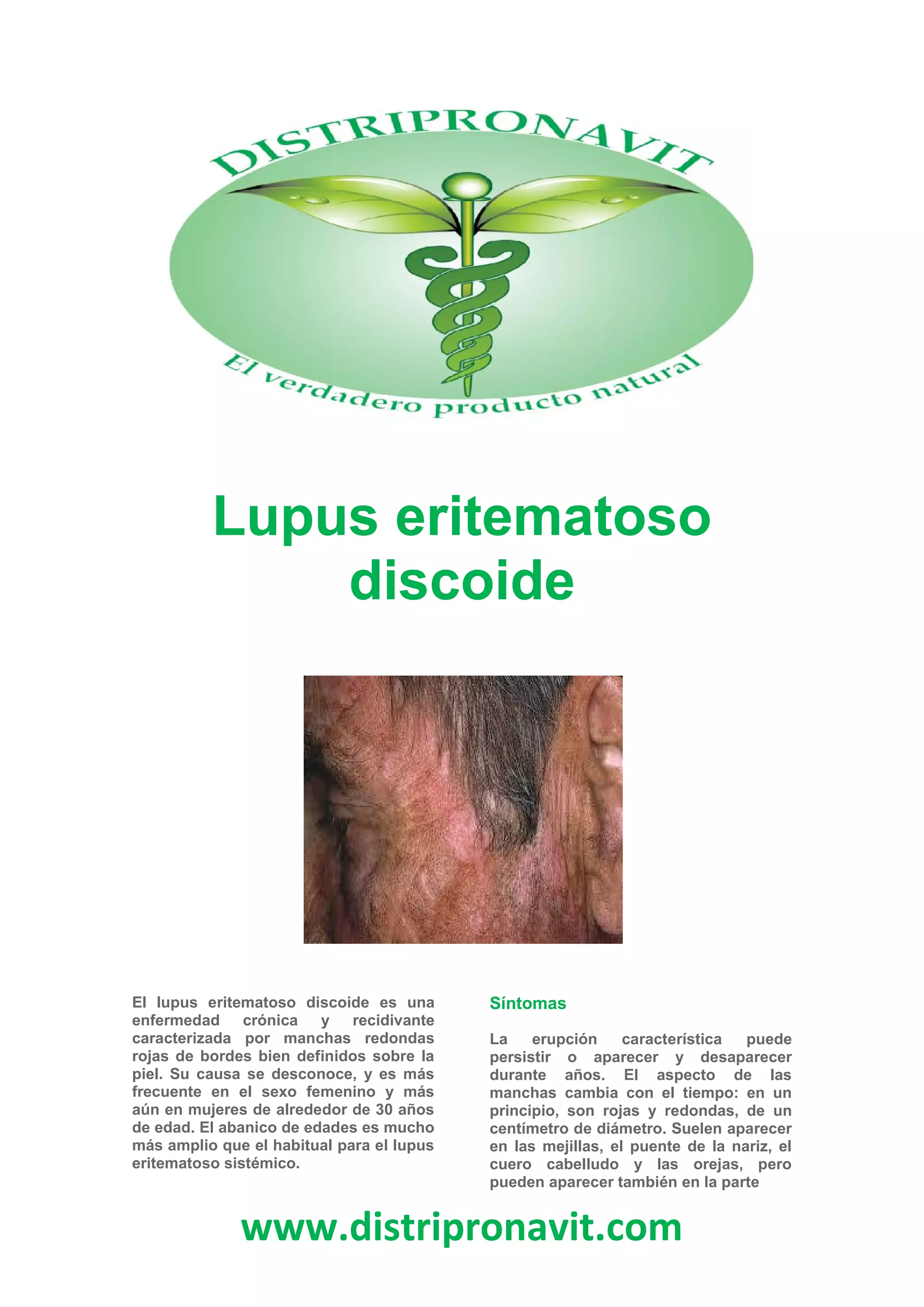 Lupus eritematoso discoide | PDF