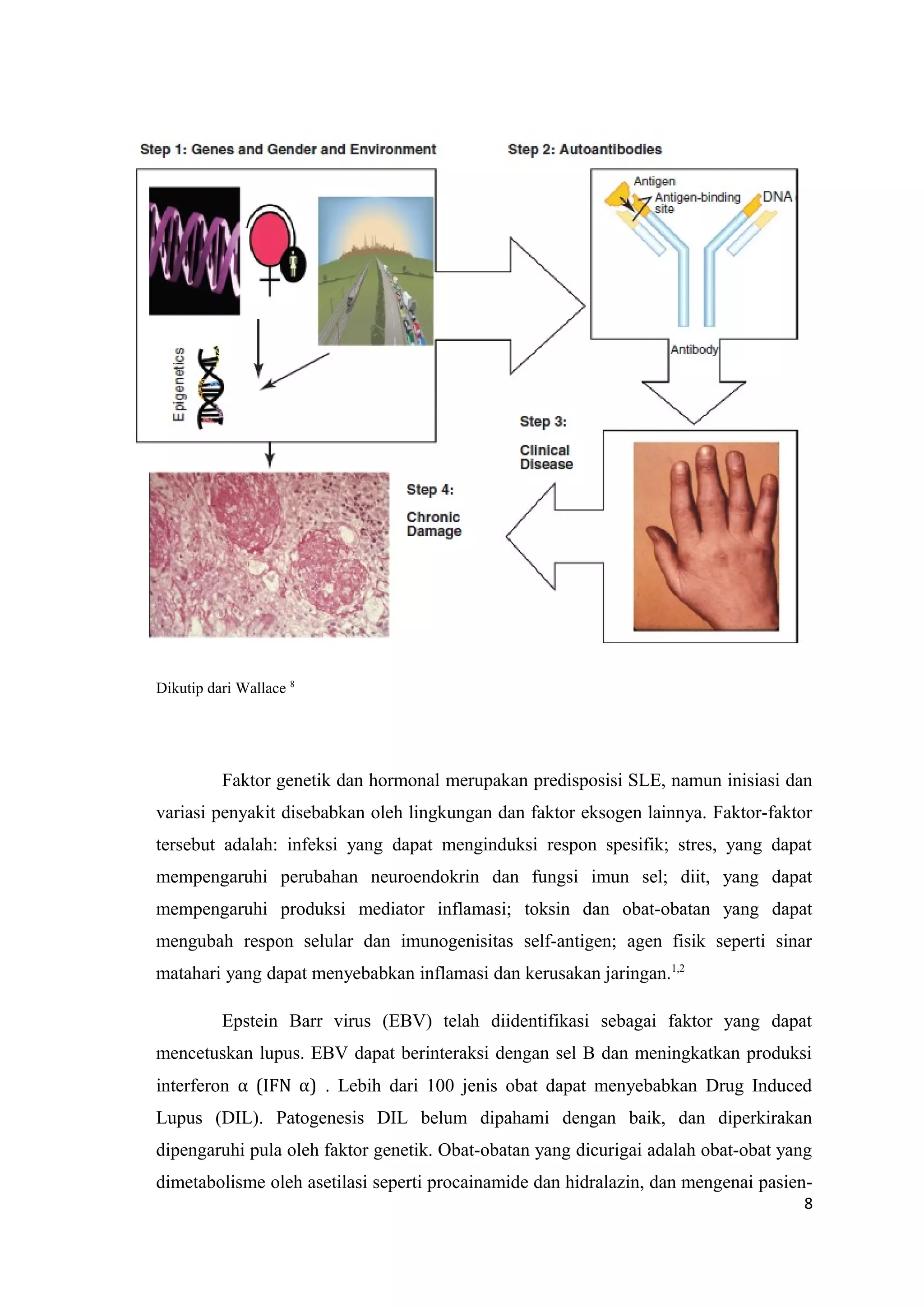 Lupus eritematosus sistemik d&t gunadi | DOC