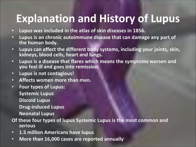 Lupus Final Presentation | PPT