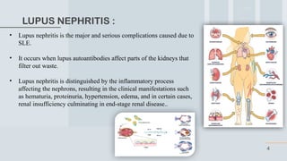 lupus nephritis..pptx complete information | PPTX