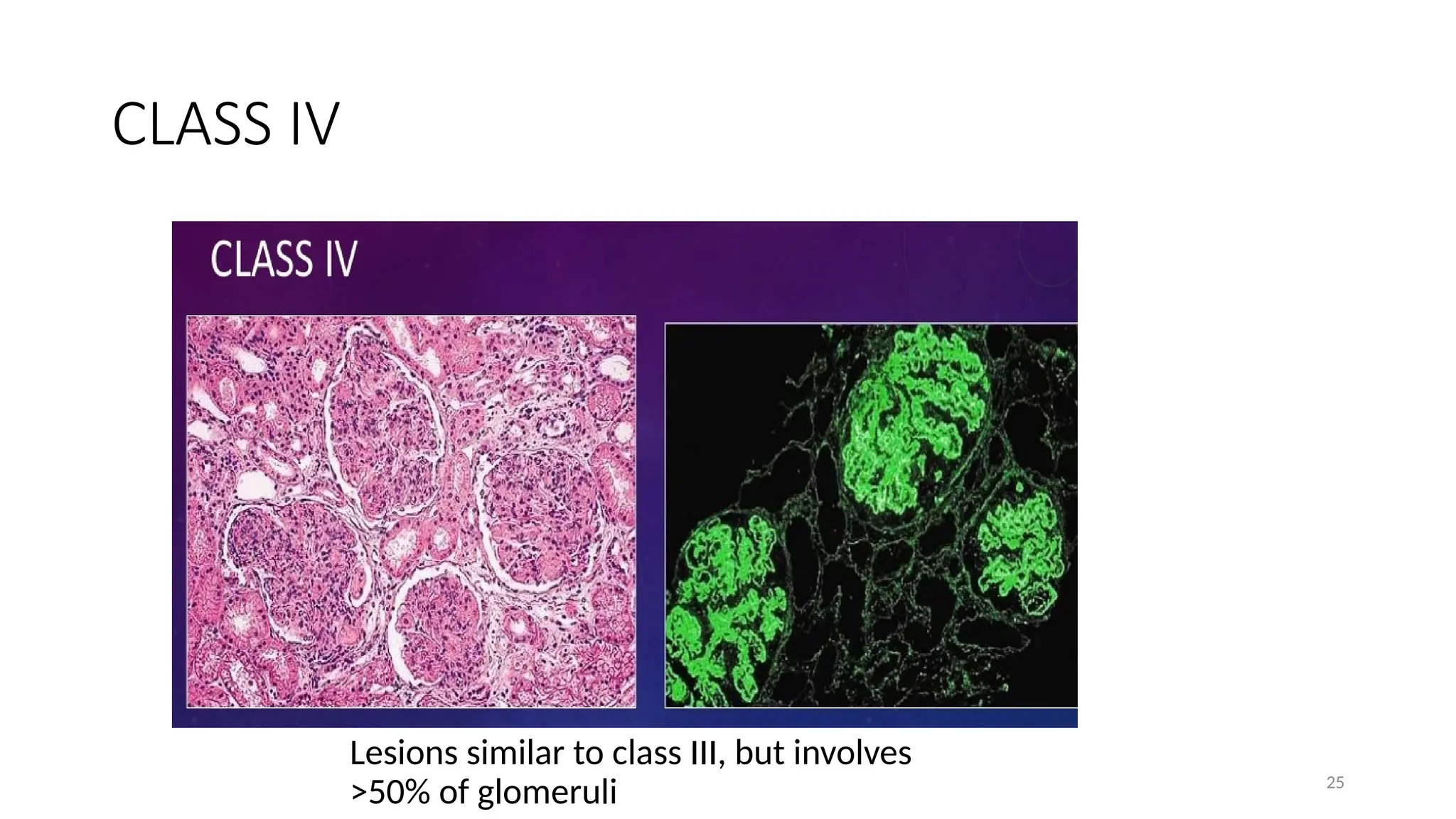 SLE lecture series for education note.pptx