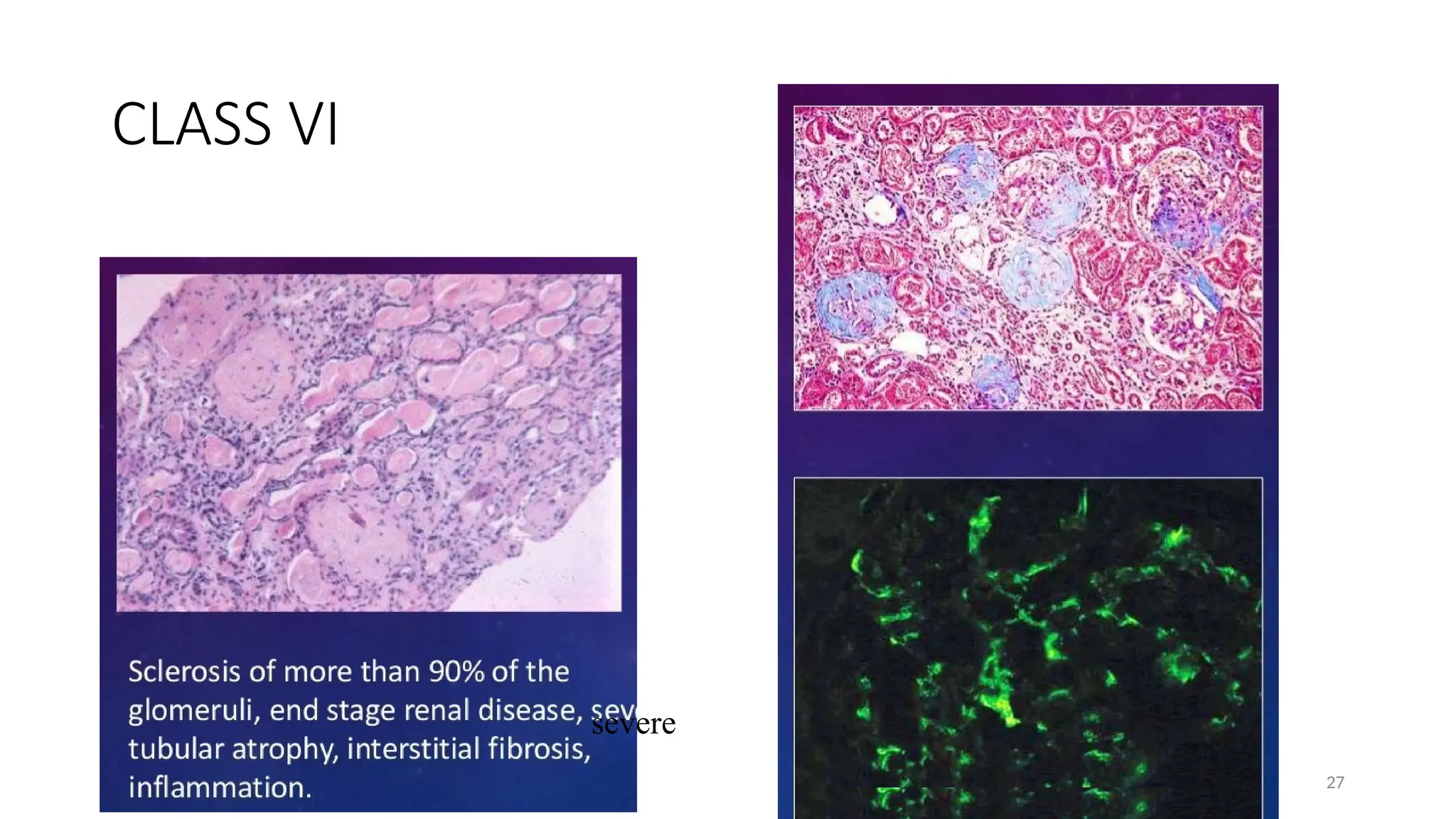 SLE lecture series for education note.pptx