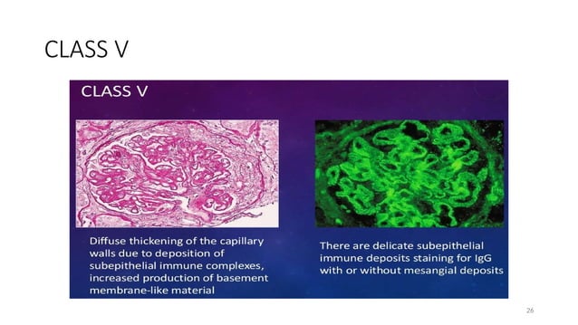 SLE lecture series for education note.pptx