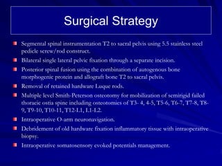 Case Review #36: 34 year old female with Adult Idiopathic Scoliosis and ...