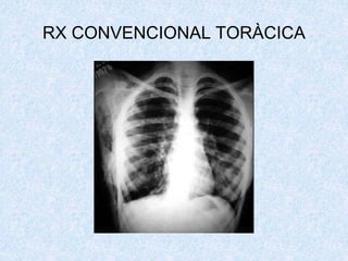 L us de les proves complementaries | PPT