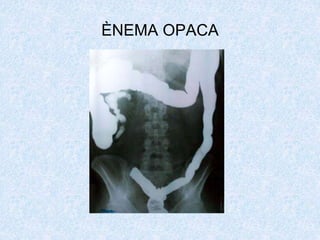 L us de les proves complementaries | PPT