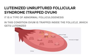 luteal phase defect.pptx