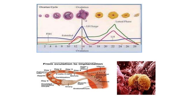 Luteal Phase Insufficiency.pptx