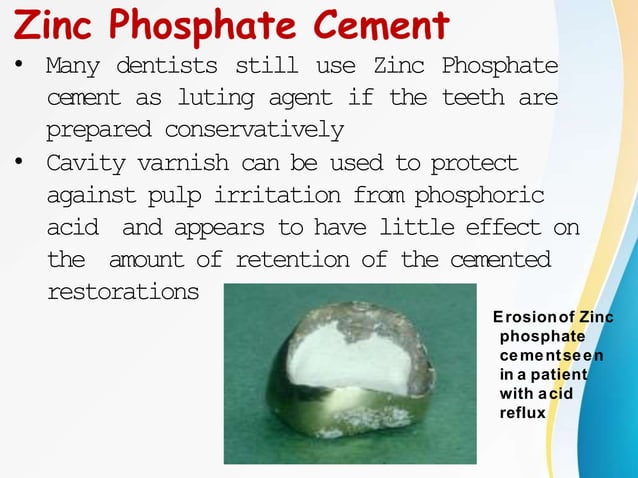 Luting agent and cementation | PPTX