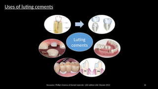 LUTING CEMENTS in prosthodontics dentistry | PPTX