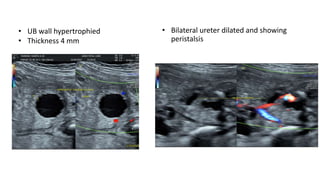 LUTO case.pptx | Pregnancy | Reproductive Health
