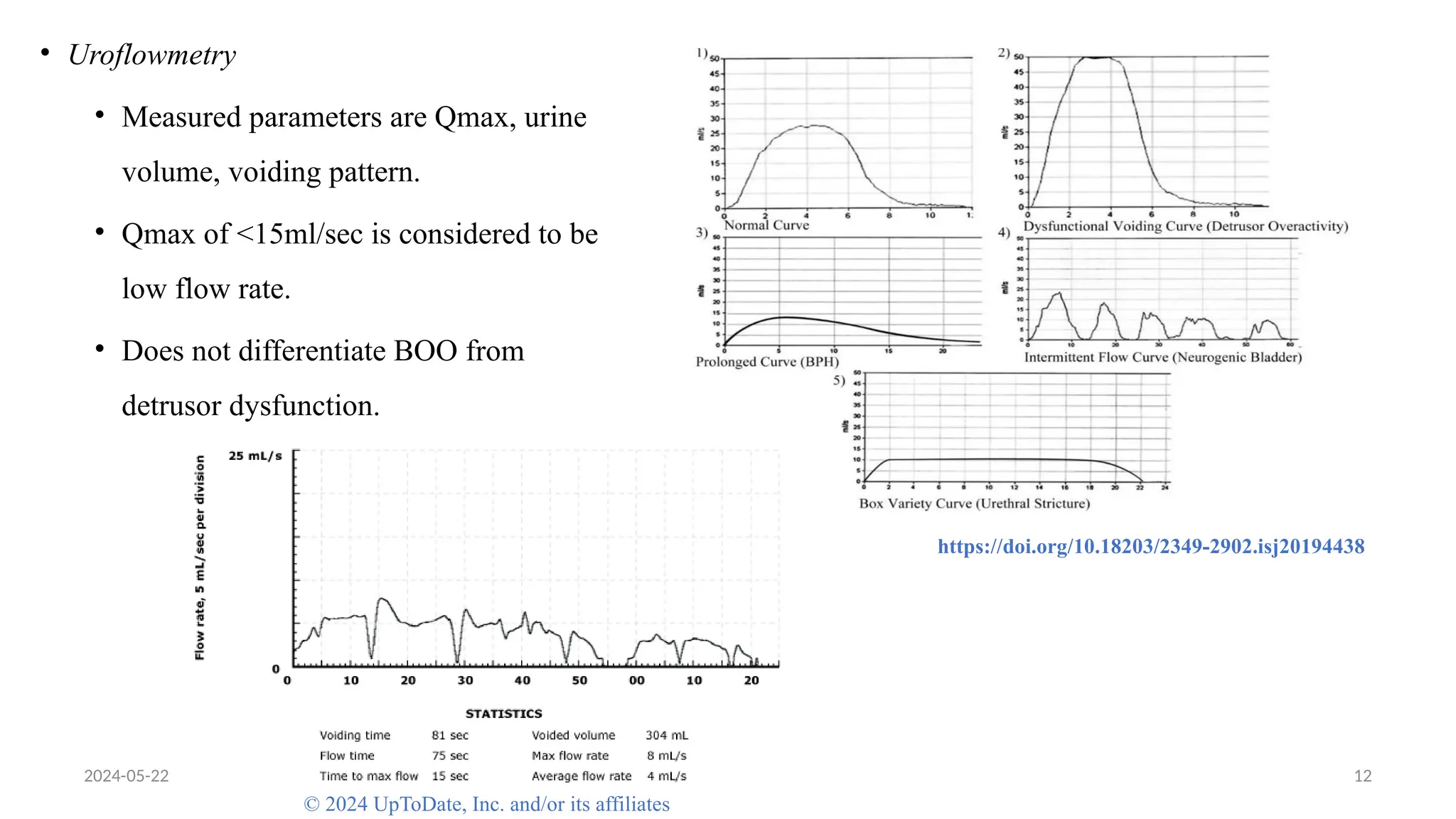 LUTO FinalLower urinary tract obstruction .pptx