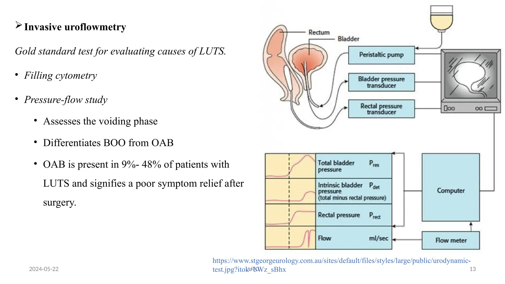 LUTO FinalLower urinary tract obstruction .pptx
