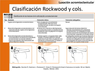 Luxación acromioclavicular y esternoclavicular | PPT