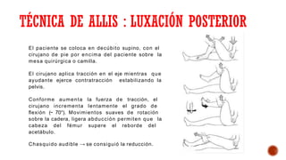 luxacion de cadera traumatologia y ortopedia | PPTX