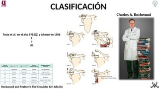 LUXACION ACROMIOCLAVICULAR - TRAUMATOLOGÍA | PPTX
