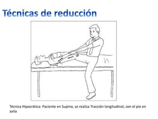 LUXACION ANTERIOR DE ARTICULACION GLENOHUMERAL (2).pptx