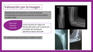 Luxacion codo | PPTX