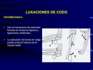 LUXACIONES DE CODO.ppt