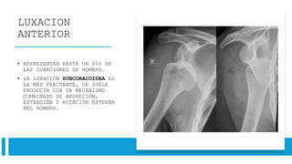 LUXACION GLENOHUMERAL EN TODO TIPO DE .pptx