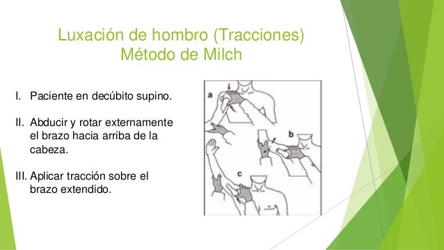 Luxacion hombro