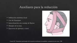 LUXACION DE ARTICULACION TEMPOROMANDIBULAR | PPTX