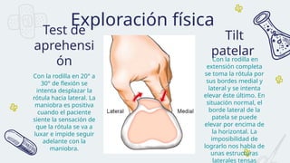 La luxación patelofemoral, también conocida como luxación de rótula, es ...