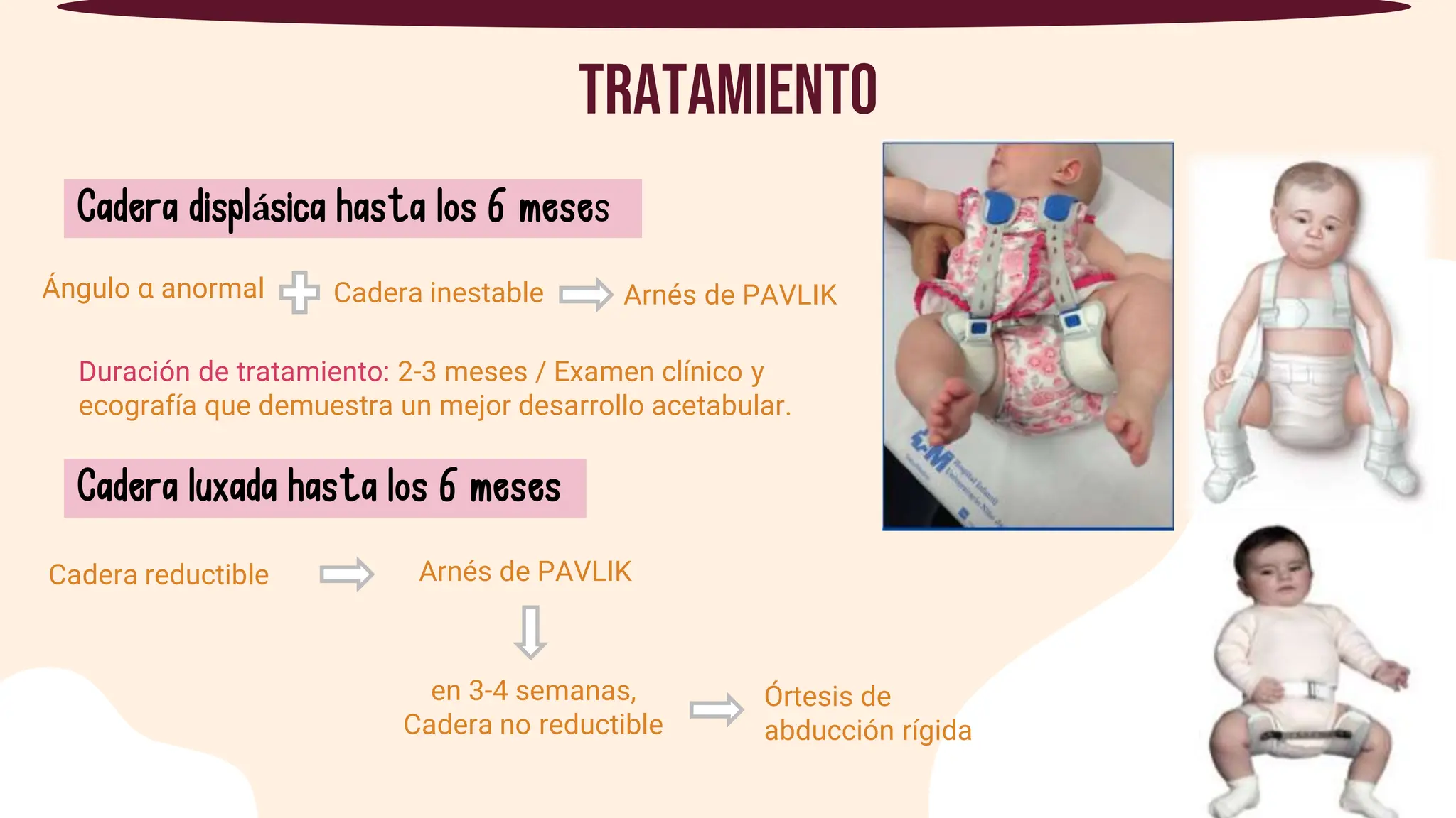 LUXACION Y DISPLASIA DE CADERA-PPT.pdf unjfsc | PPT