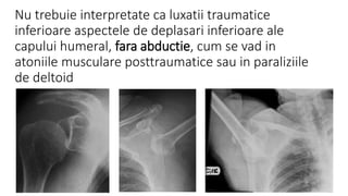 Luxatia scapula-humerala.pptx