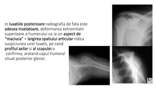 Luxatia scapula-humerala.pptx