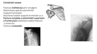 Luxatia scapula-humerala.pptx