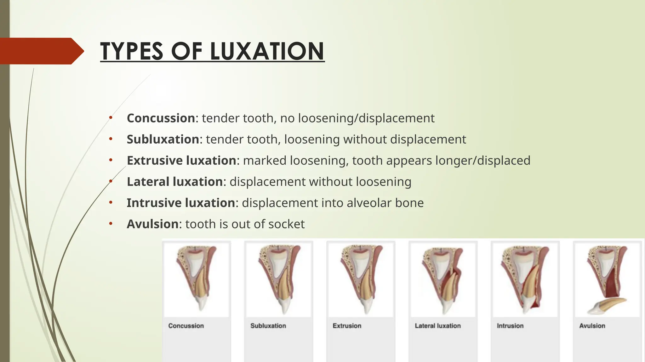 LUXATION injury of tmj with mouth and jaw | PPT