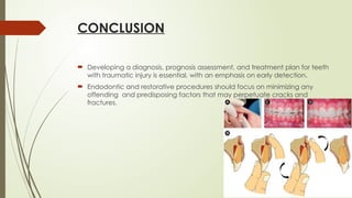 LUXATION injury of tmj with mouth and jaw | PPT