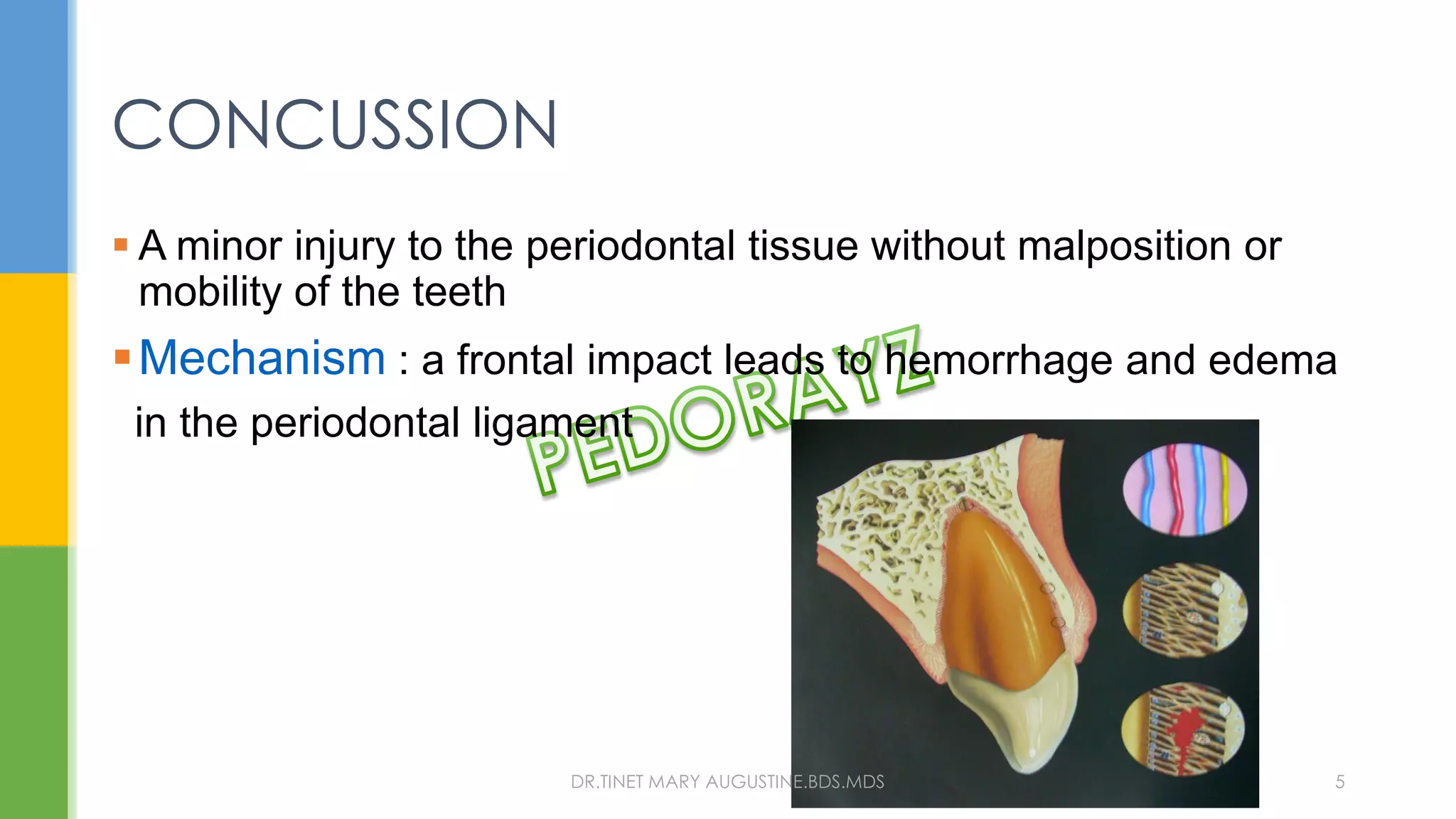 Luxation injuries and avulsion | PDF