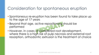 Luxation injuries and avulsion | PDF