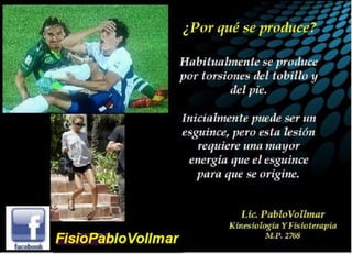 luxofractura de tobillo fisio pablo vollmar.PDF