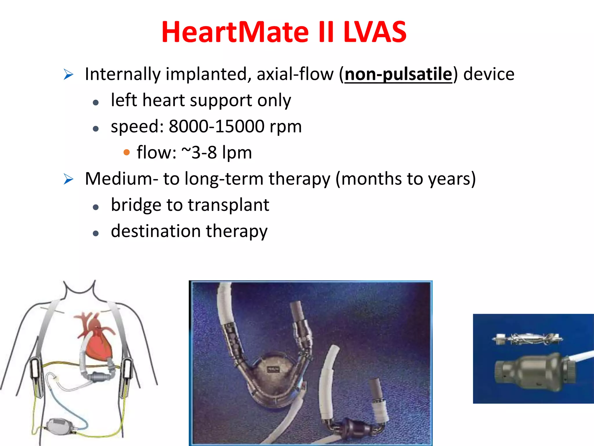 LVAD - Left Ventricular Assist Device | PPTX