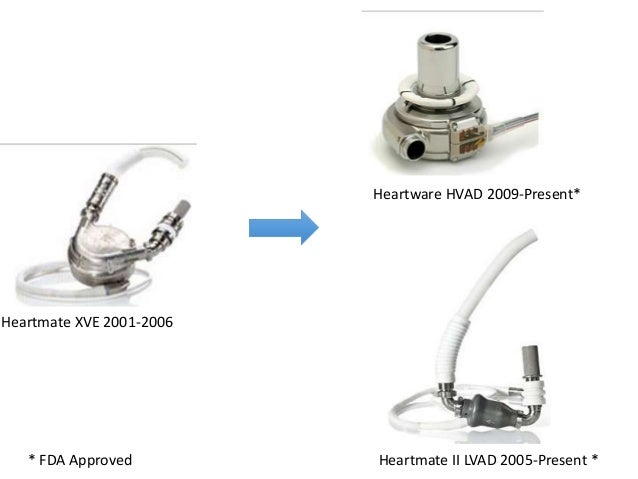 LVAD - Left Ventricular Assist Device
