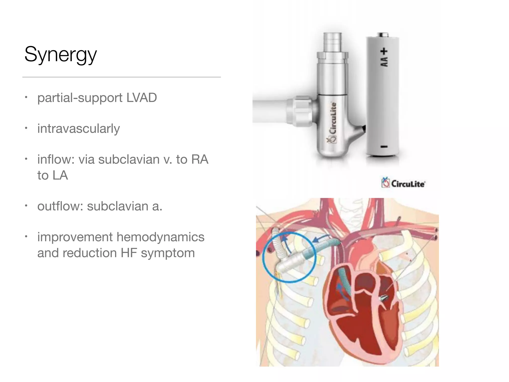 Ventricular assist devices | PDF