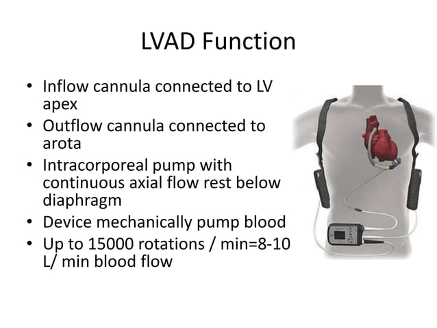 LVAD.pptx
