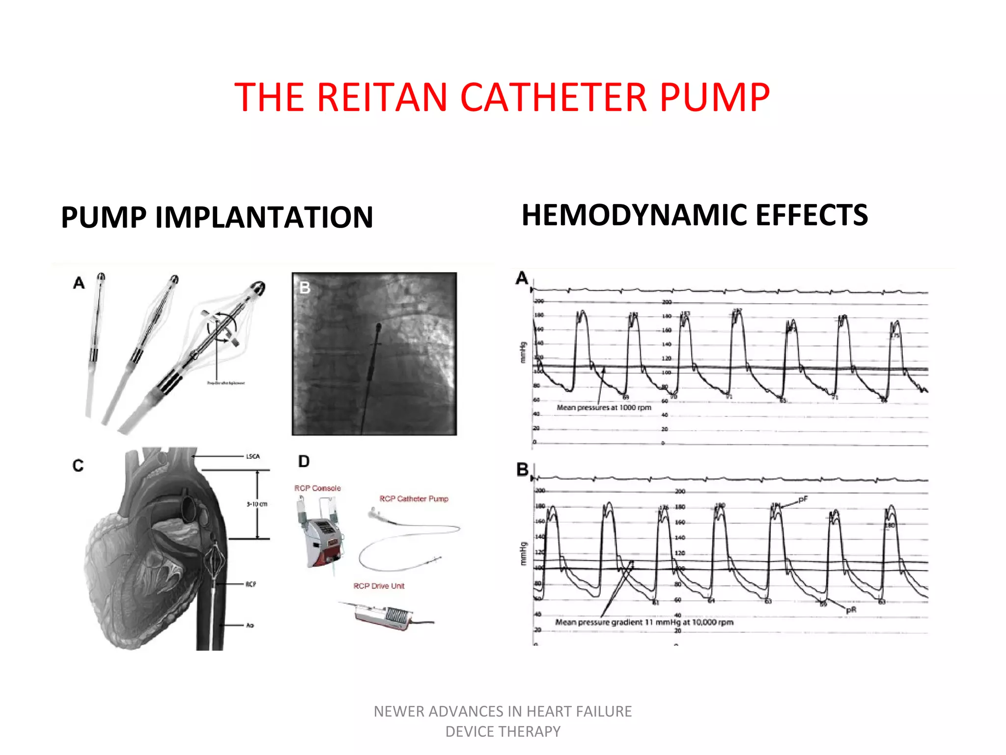 heart failure device therapy | PPT