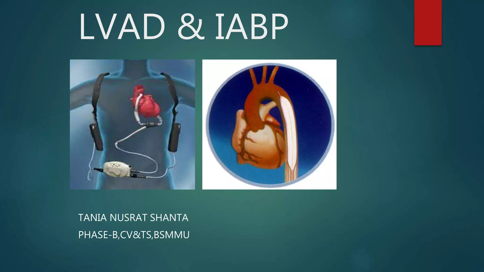 LVAD & IABP by DR. T.N.Shanta.final | PPT