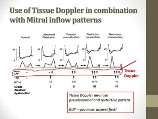 LV diastolic filling patterns – normal and impaired relaxation ...
