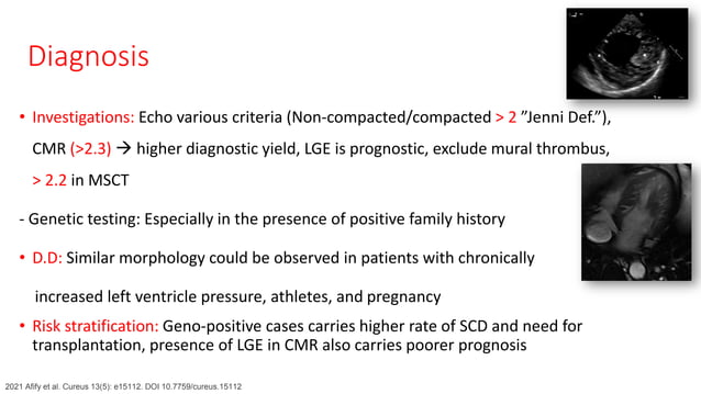 LV non-compaction cardiomyopathy | PDF | Heart and Cardiovascular ...
