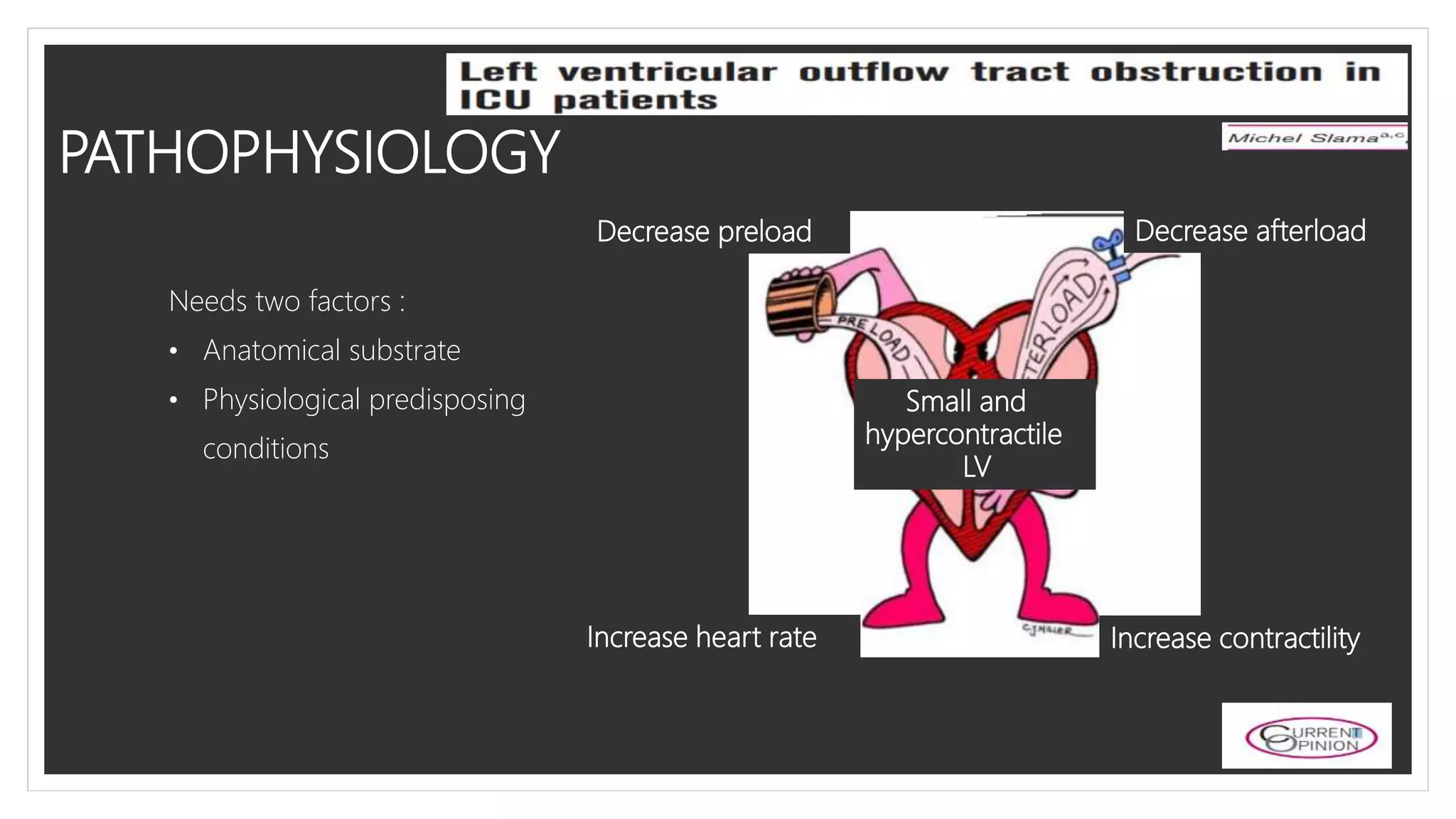 LVOT OBSTRUCTION IN ICU | PPTX