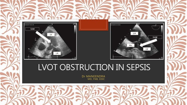 LVOT OBSTRUCTION IN ICU | PPTX | Heart and Cardiovascular Diseases ...