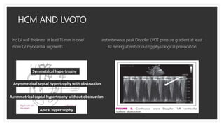 LVOT OBSTRUCTION IN ICU | PPTX | Heart and Cardiovascular Diseases ...
